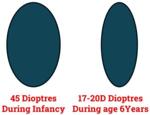 Emmetropization- The process of Achieving 6/6 or Normal Visual Acuity ...