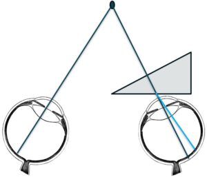 Ophthalmic Prism- Everything you need to know as an Optometrist ...