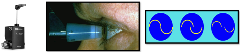 7 Investigations for Glaucoma Diagnosis every Optometrists Should Know ...