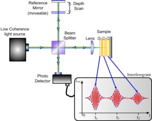 Optical Coherence Tomography- Everything you need to know as an ...