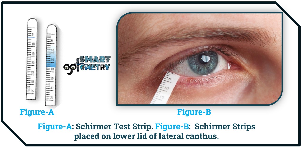 Schirmer Tests- Everything you need to know. - Smart Optometry