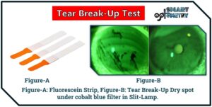 Tear Break-Up Time Test (TBUT) – Everything you need to know. - Smart ...