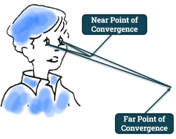 Convergence of Eyes – Everything you need to know about. - Smart Optometry