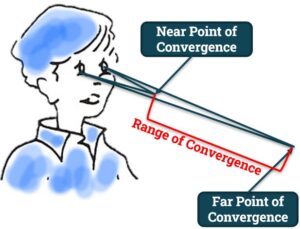 Convergence of Eyes – Everything you need to know about. - Smart Optometry