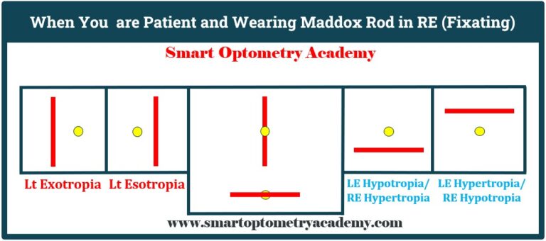Maddox Rod Test- Everything You Need to Know. - Smart Optometry