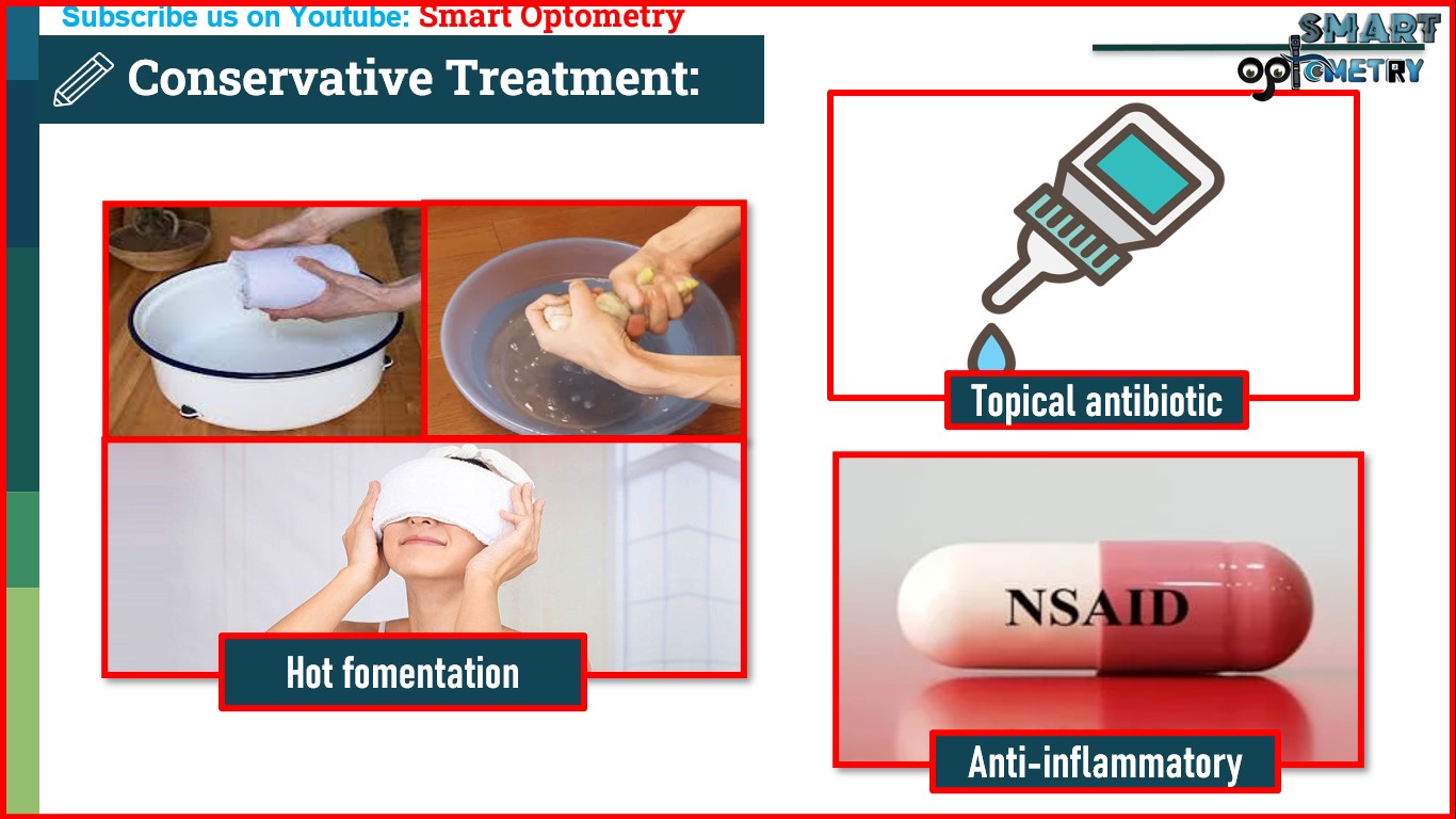 Chalazion- Definition, Mechanism, Causes, Symptoms, Signs, Treatment ...