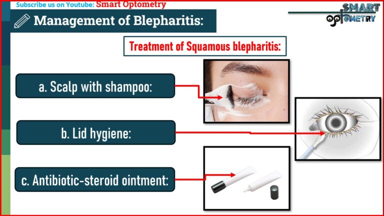 Blepharitis – Introduction, Causes, Symptoms, Signs, Treatment ...