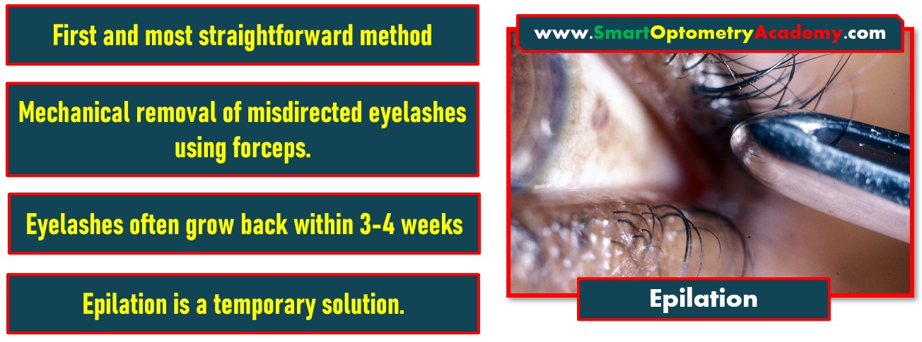 Trichiasis- Definition, Causes, Symptoms, Signs & Treatment. - Smart ...