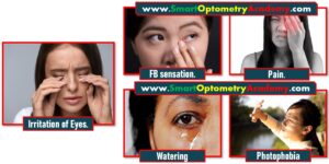 Trichiasis- Definition, Causes, Symptoms, Signs & Treatment. - Smart ...