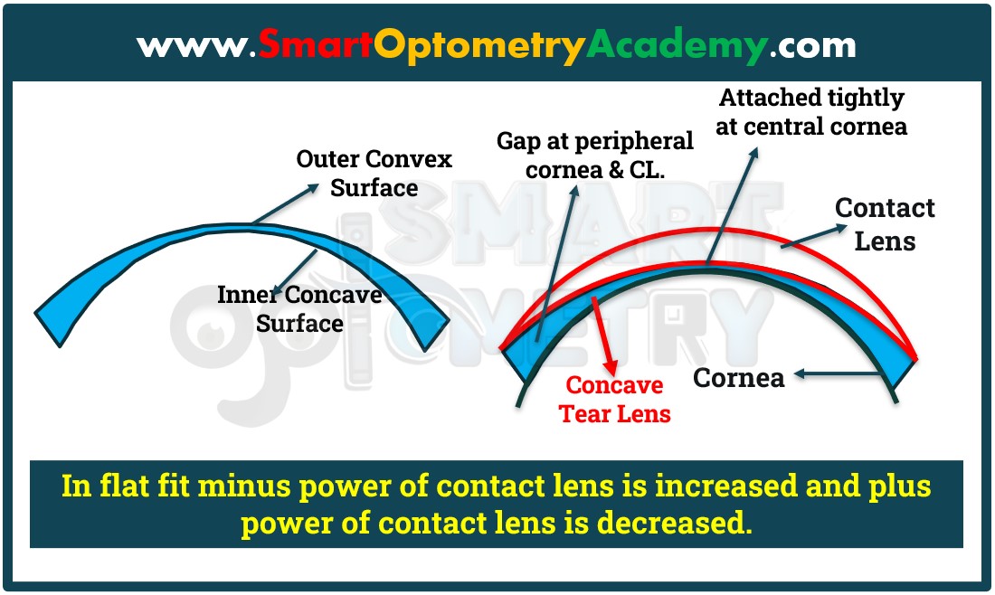 Contact Lens- Over Refraction Calculation in Just 3 Simple Steps ...